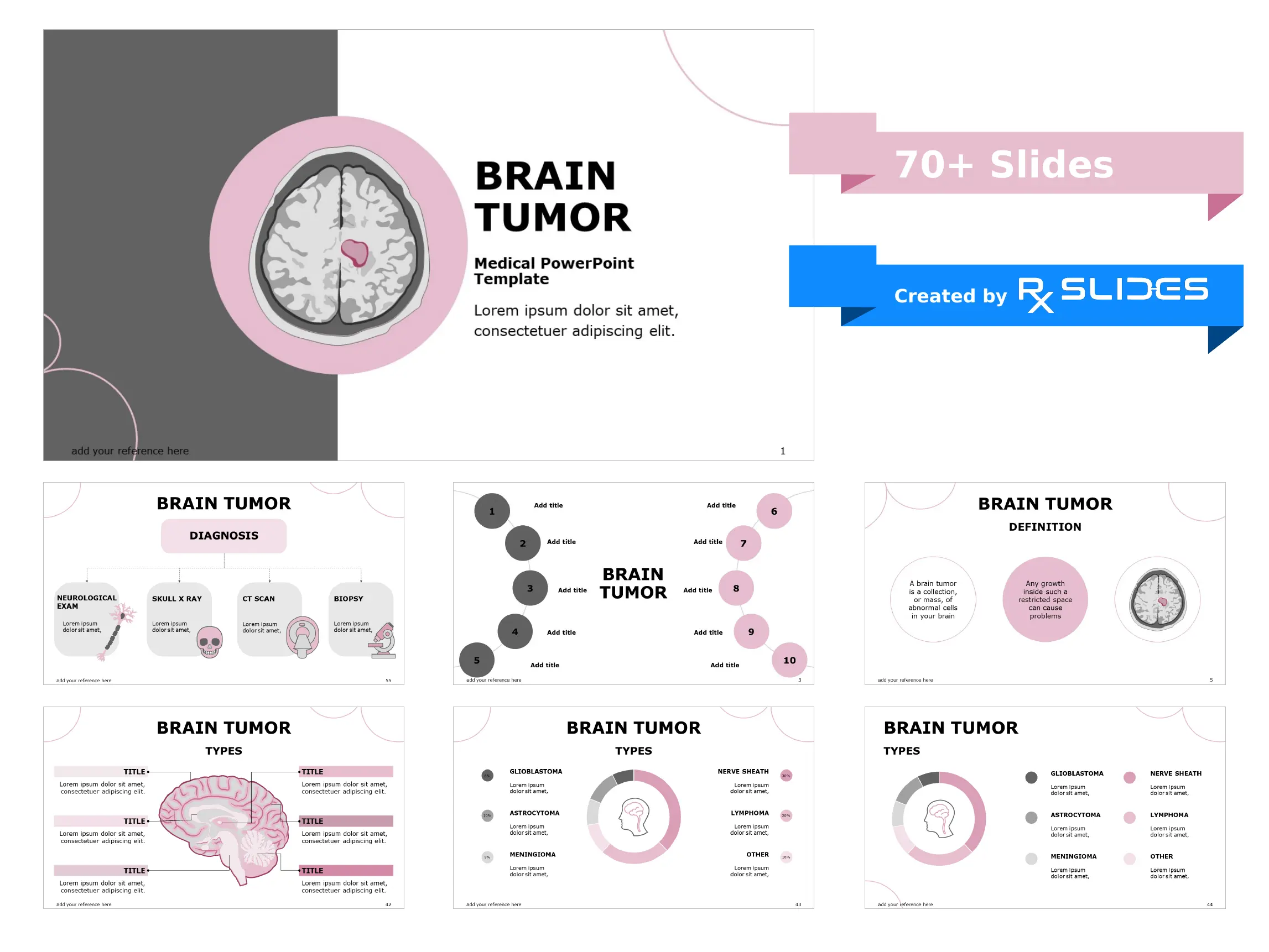 Download Brain Tumor PowerPoint Template|RxSlides